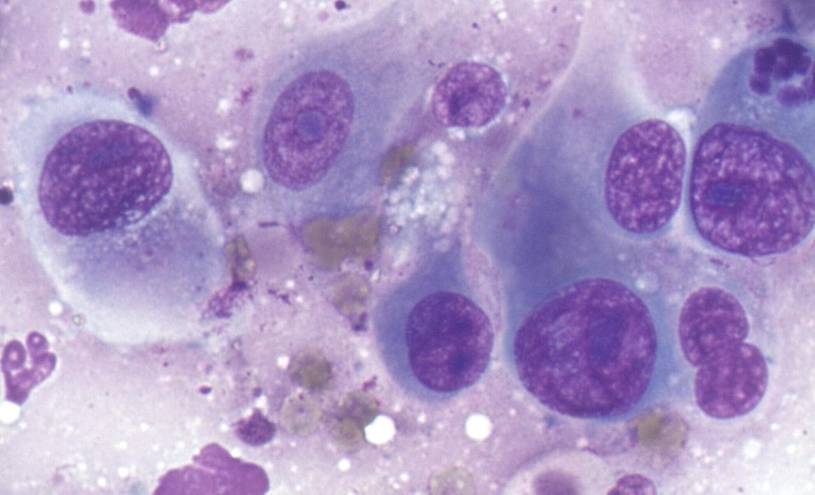 MUTACIÓN BRAF: Nueva PCR en LABOKLIN para diagnóstico de carcinoma de ...